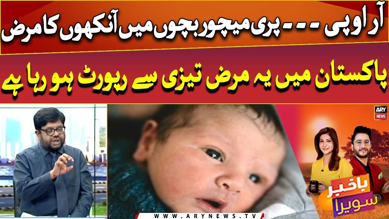 ROP Eye Disease In Premature Babies Pakistan Mai Tezzi Se Barhte rop-eye-disease-in-premature-babies-pakistan-mai-tezzi-se-barhte