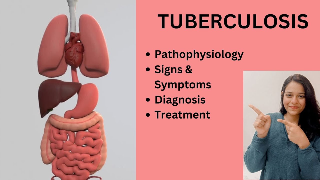 Tuberculosis (TB) || Signs &Symptoms || Pathophysiology || Diagnosis ...