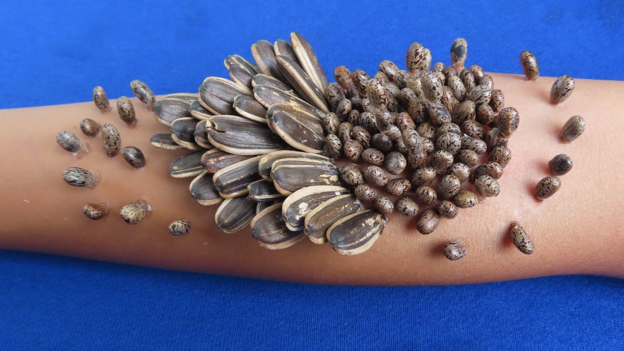 How to remove a lot of ticks style on arm boy | Designed from cereals ...