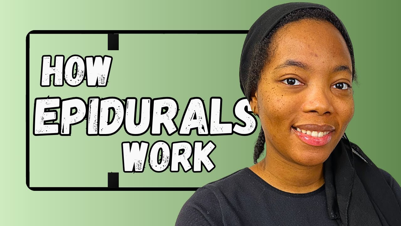 Everything You Must Know About Epidurals | What to Expect - YouTube