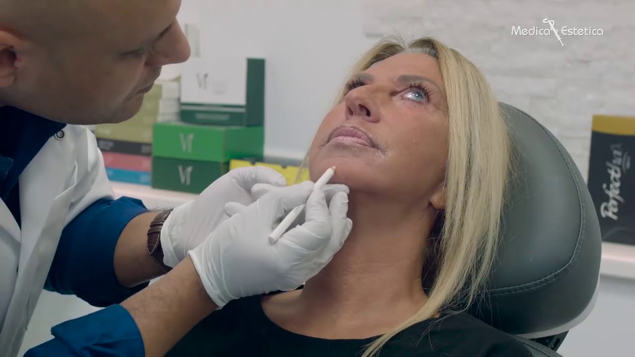 Kin en kaaklijn correctie - YouTube