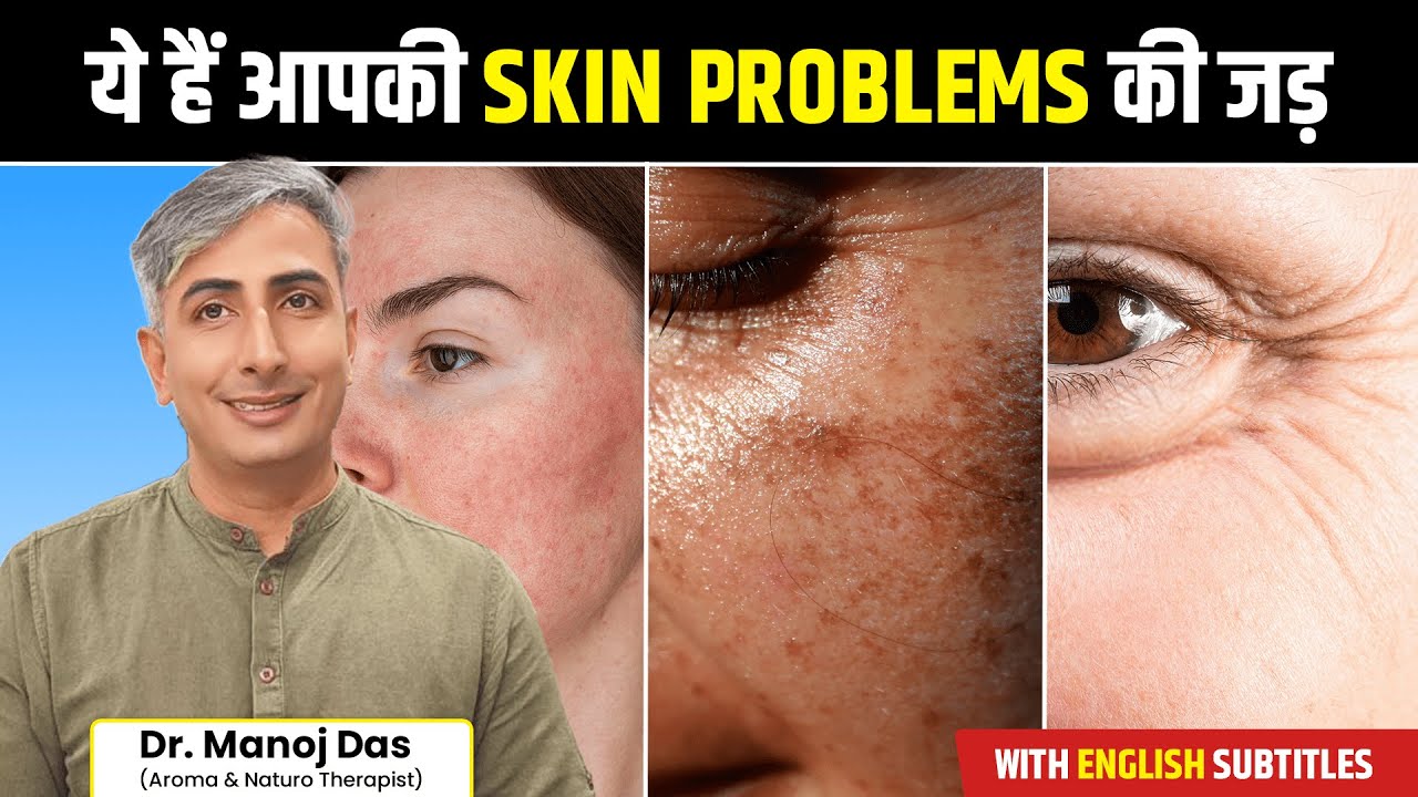 आपकी हर Skin की समस्या का समाधान है ये वीडियो | All Skin Problems ...