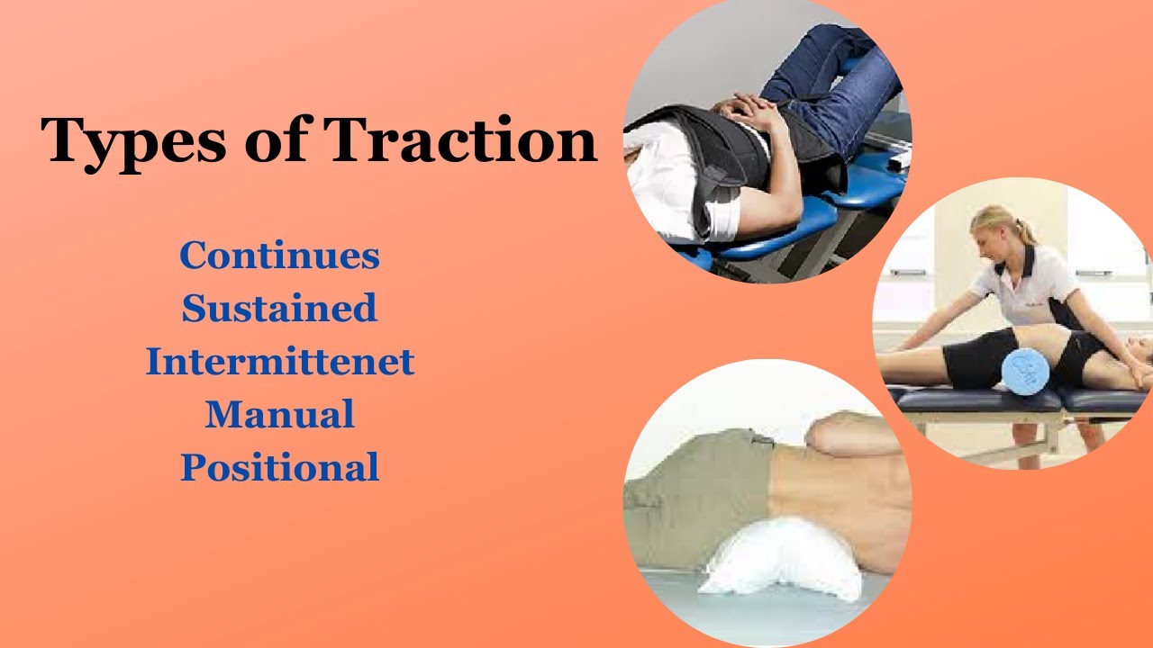 Types of Traction: Continuous, Sustained, Intermittent, Manual ...