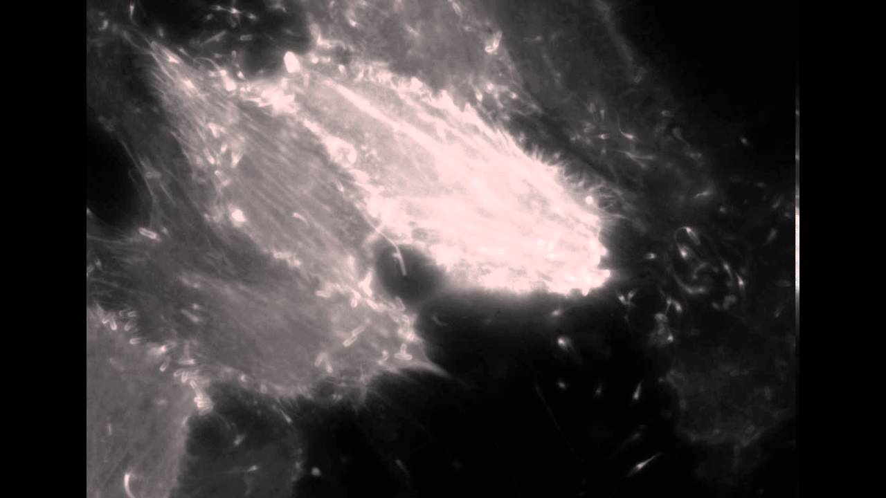 Listeria monocytogenes intracellular motility (iv) - YouTube