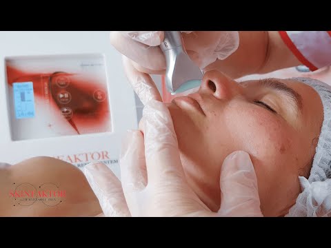 Skinfaktor | THE MEDILIFT TREATMENT