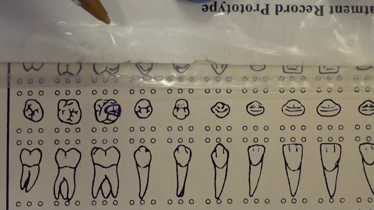 Hard Tissue Charting Part 2 - YouTube