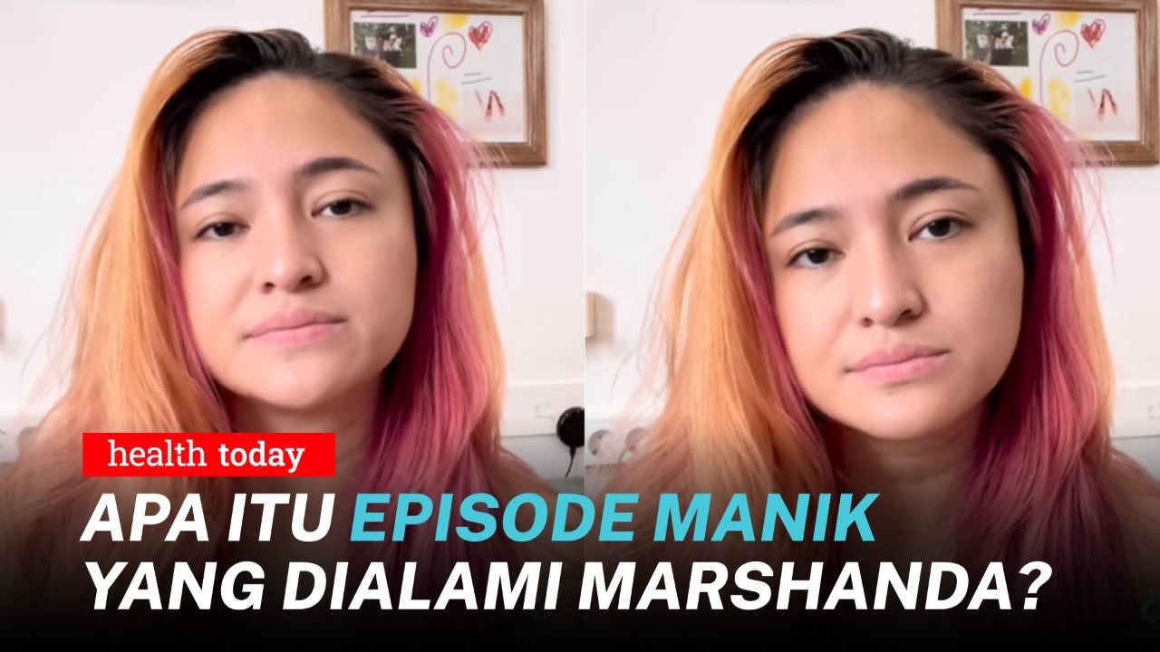 Marshanda Sudah Ditemukan! Begini Penjelasan Dokter Soal Bipolar Yang ...