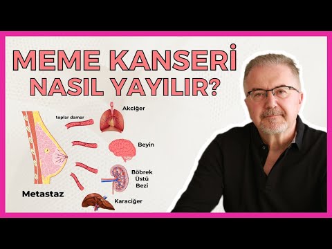 Meme Kanseri Nasıl Yayılır?
