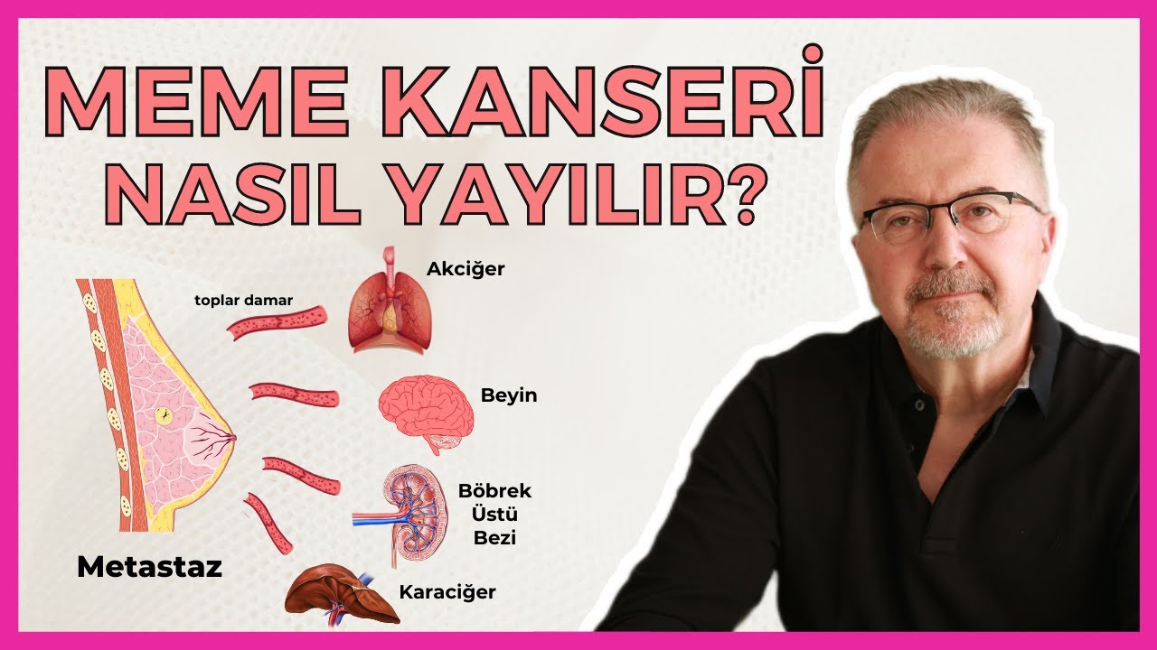 Meme Kanseri Nasıl Yayılır? - YouTube