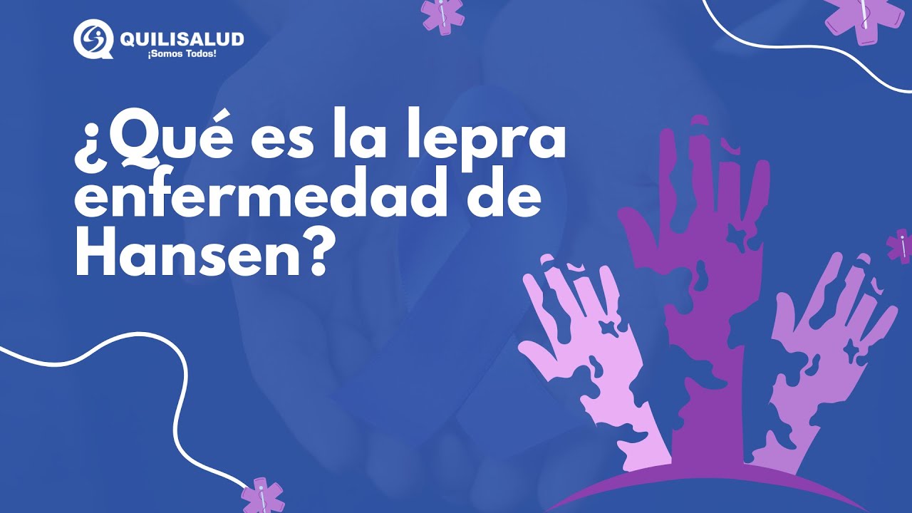 ¿Qué es la Lepra o Enfermedad de Hansen? I Quilisalud - YouTube