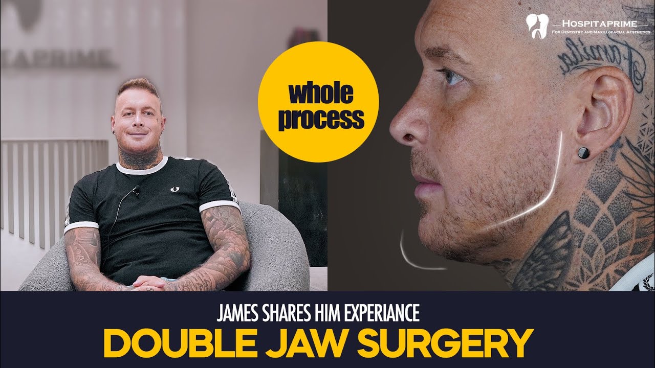 Double Jaw(Orthognathic) Surgery for Sleep Apnea patient / post surgery ...