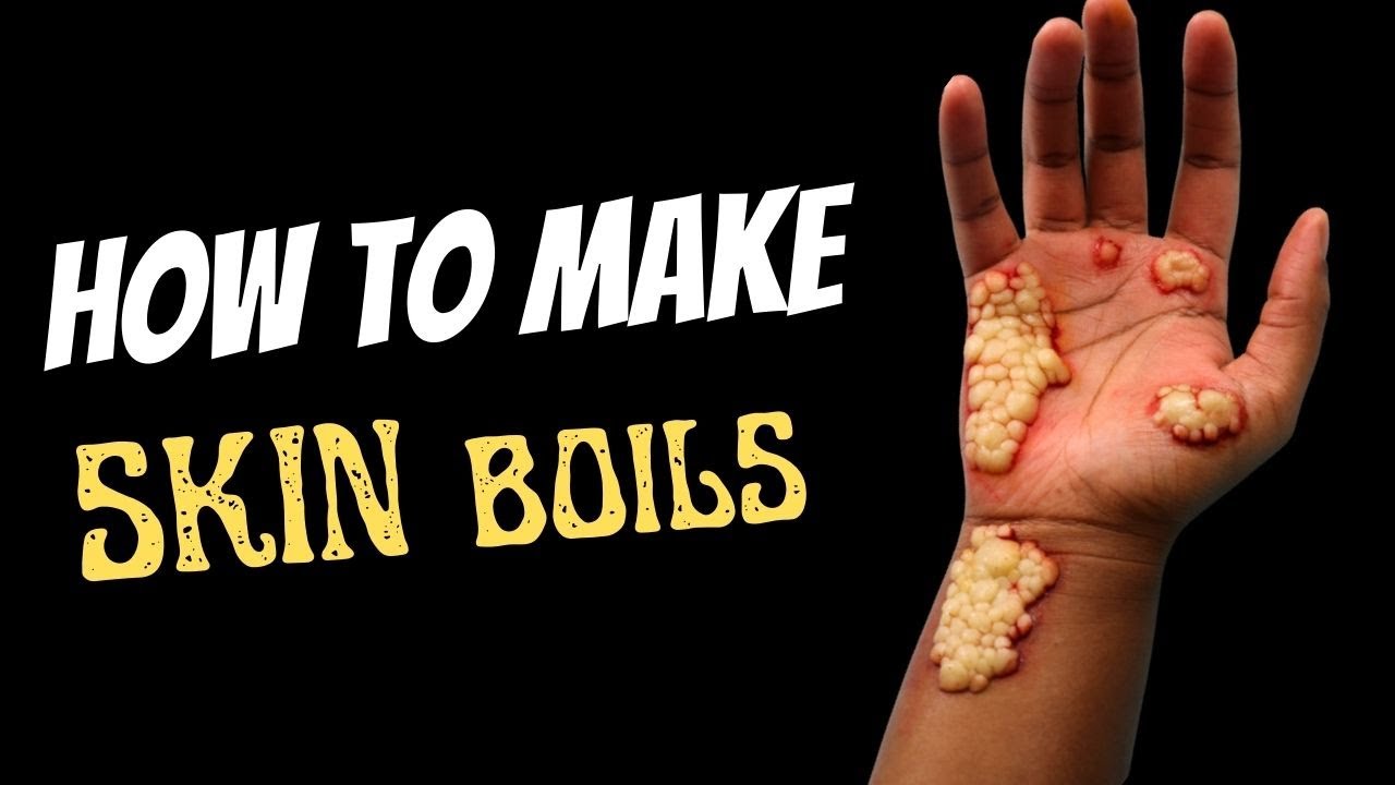 How to Make Skin Boils!! [SFX Makeup Tutorial] - YouTube