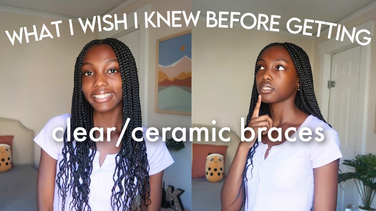 what i wish i knew before getting clear/ceramic braces - YouTube