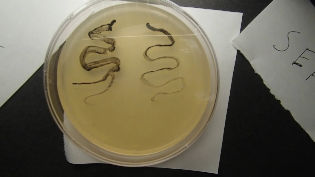 Staphylococcus aureus(left) Staphylococcus epidermidis(right)-BP - YouTube