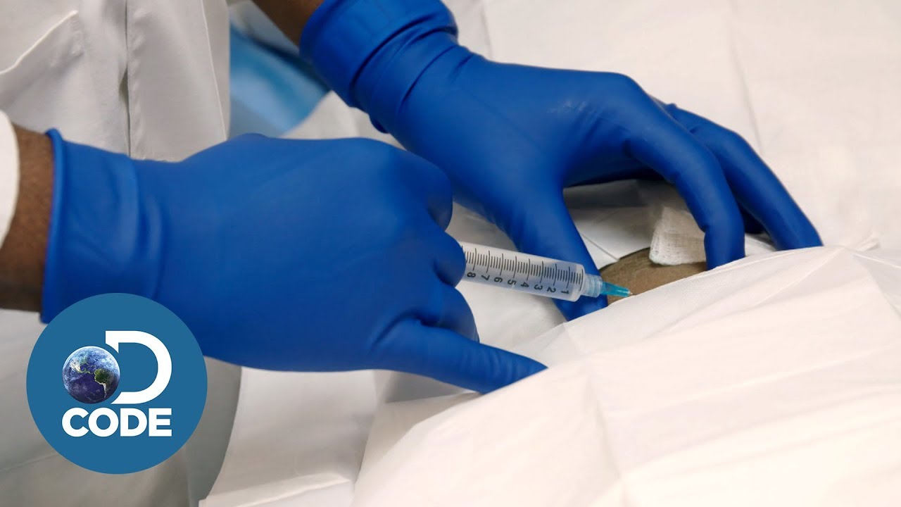 First In Human EP2 (5/6) | Bo's Steroid Injection - YouTube