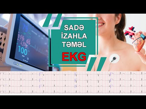 Sadə izahla təməl EKG-nin izahı / EKG öğrenme / ECG learning #EKG #ECG #Medical #Sağlık #DoktorAZCom