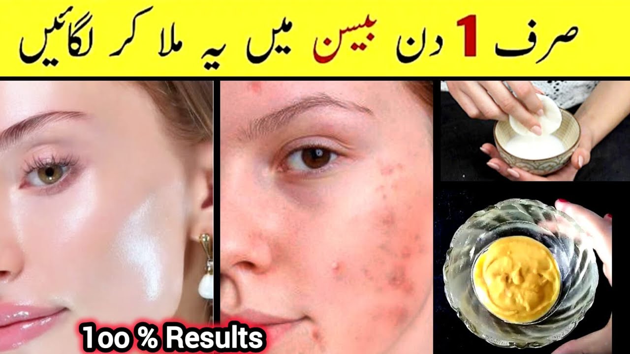 Besan Face Pack For glowing skin|Homemade Face Pack For glowing skin|Naturally Glowing skin ...