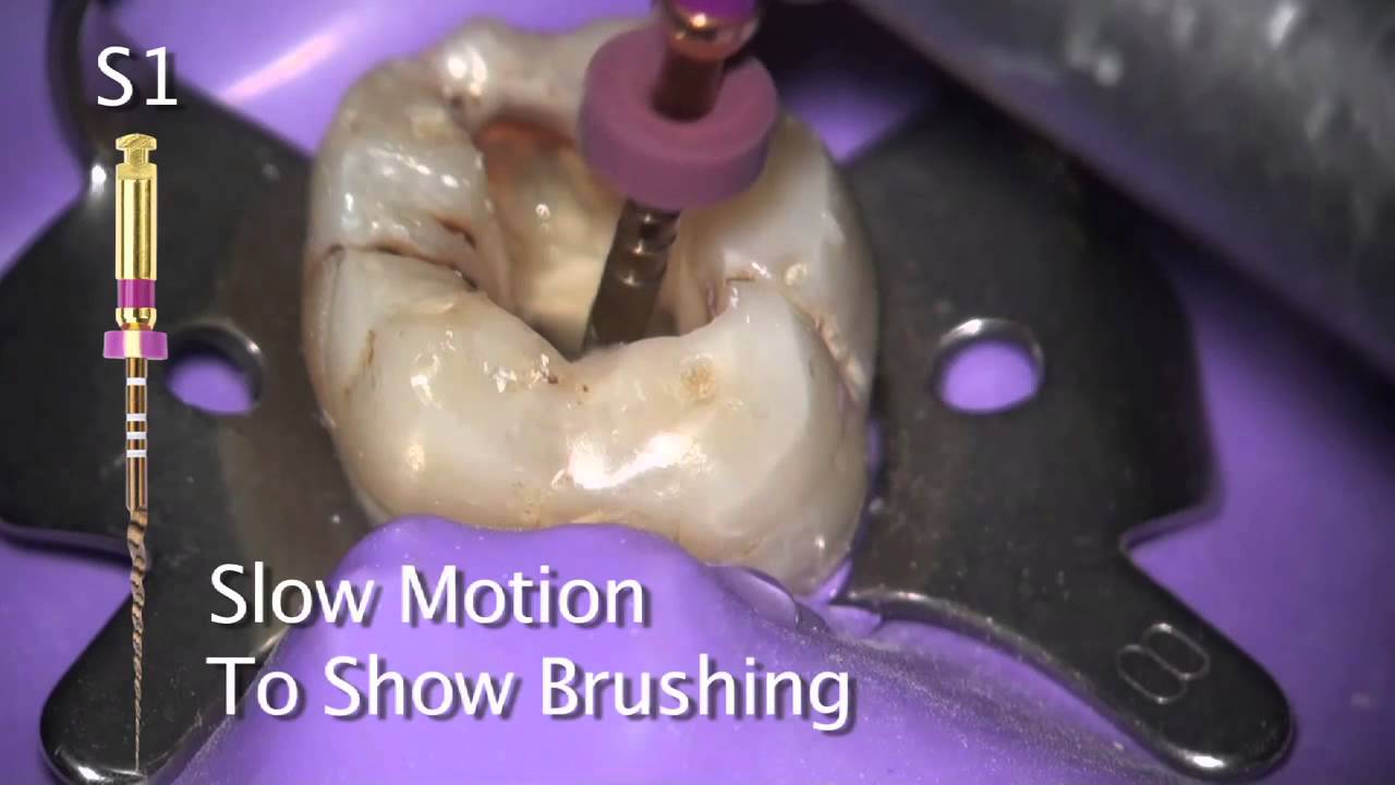 ProTaper Gold Technique with Dr. Jim Gutmann | Dentsply Sirona - YouTube