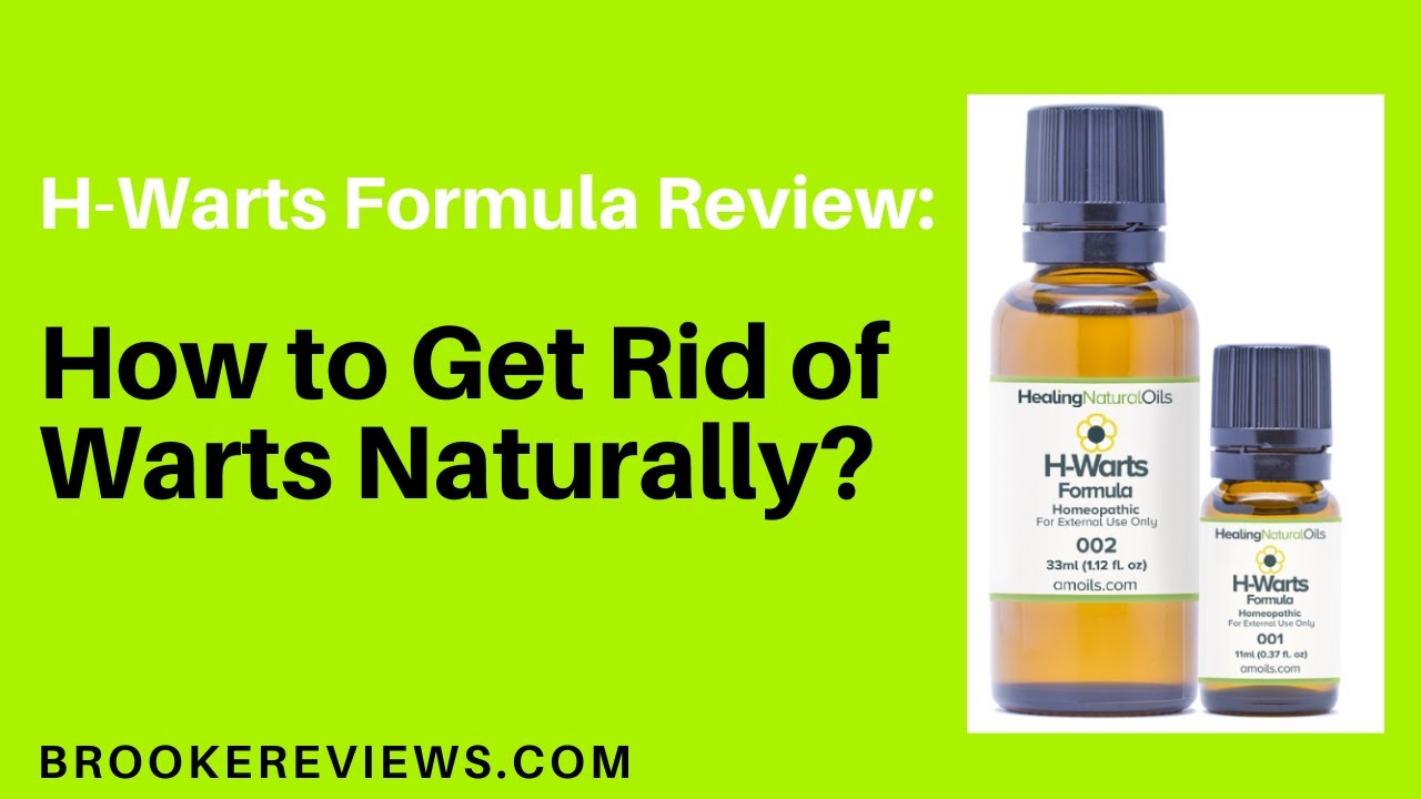 H Warts Formula Review: How to Get Rid of Warts Naturally? - YouTube