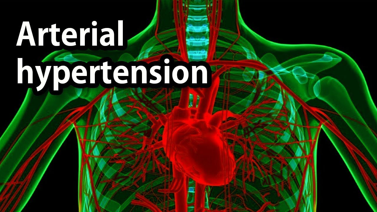 Arterial Hypertension