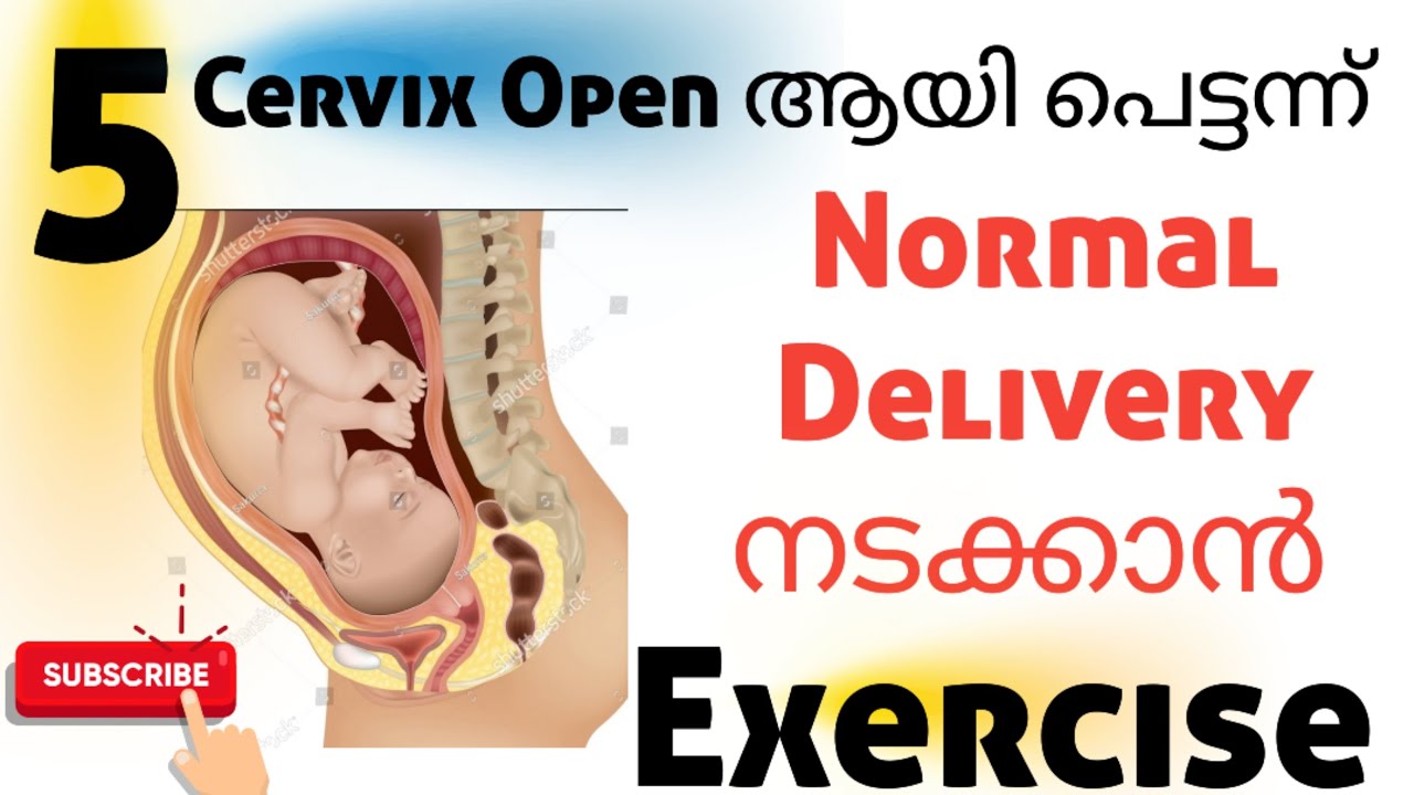 Normal Delivery Cervix Open easy exercise Malayalam #pregnancyexercise ...