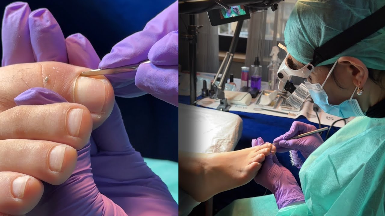 Clase de Pedicura - YouTube