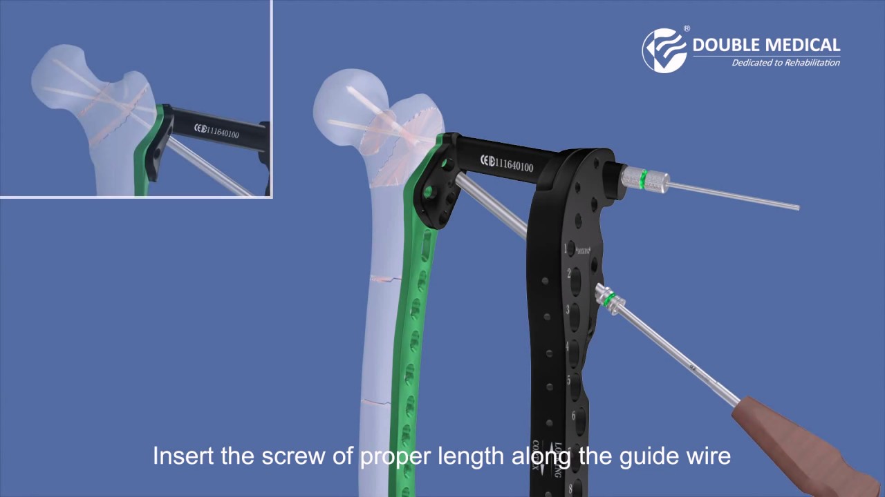 Neck Femur Growth Plate