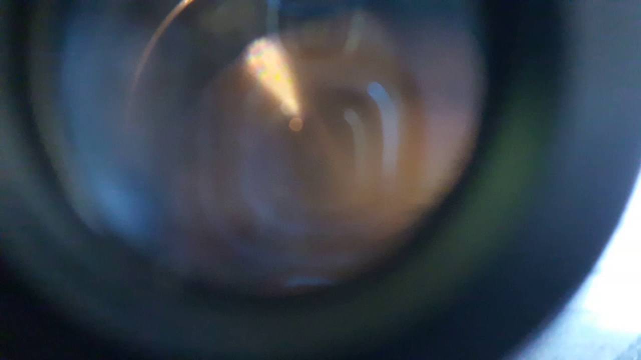 bacterial Motility By hanging drop technique video - YouTube