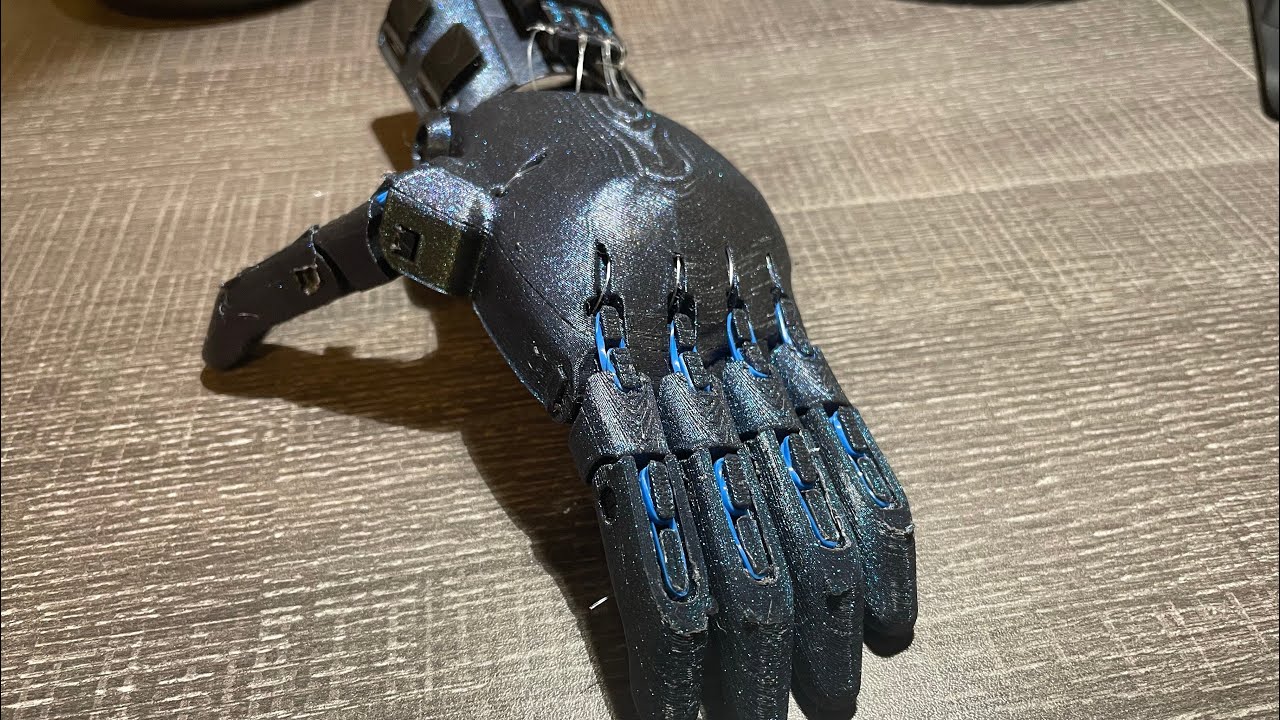 3D prosthetic hand - Enable - YouTube