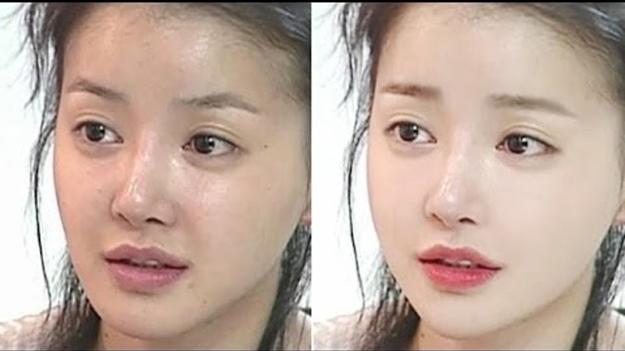 Photo Editing Tutorial How To Remove Acne Pimple on Android Phone By ...