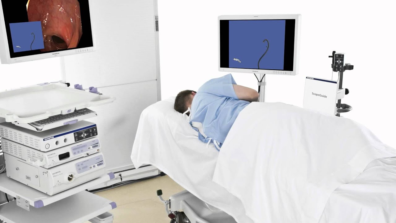 Olympus ScopeGuide - YouTube