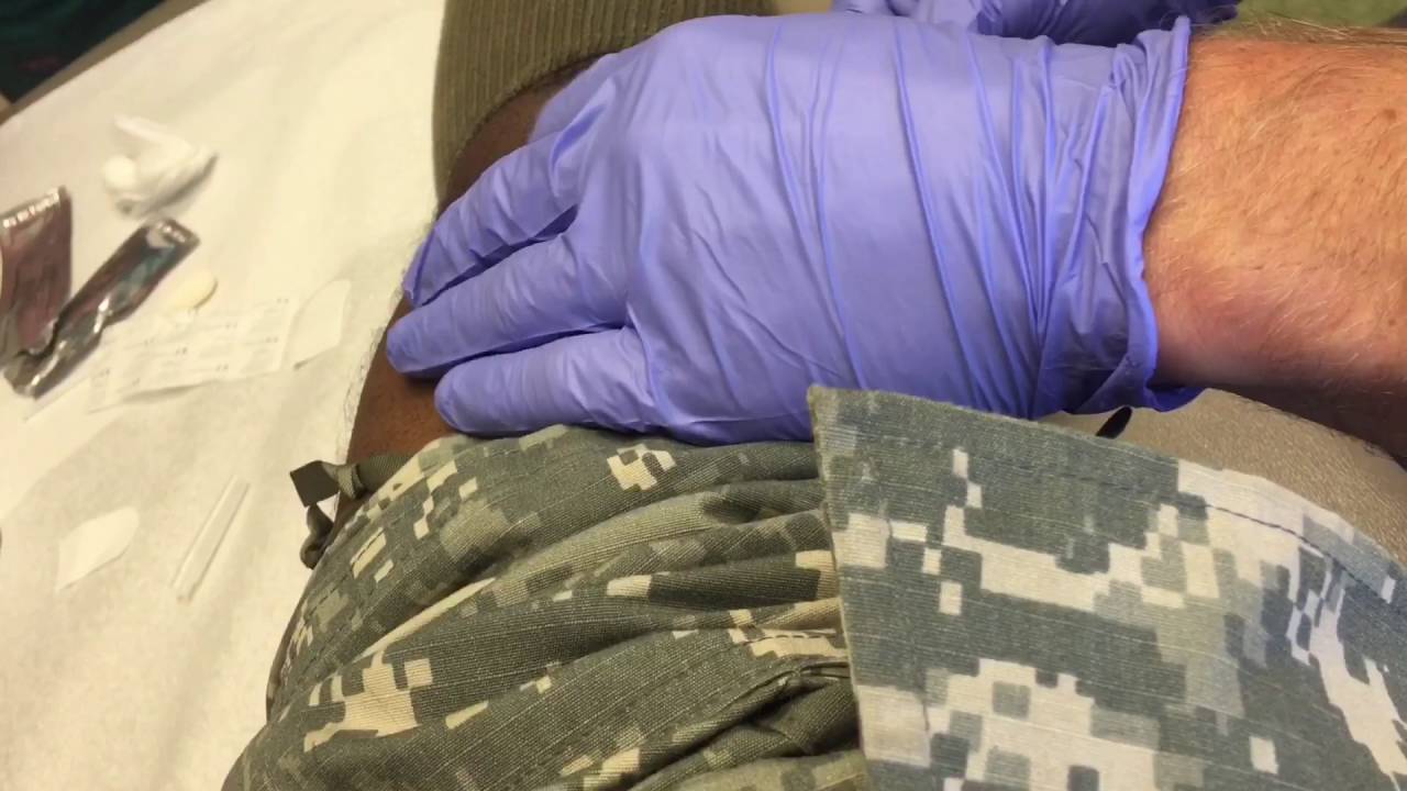 Bi-Annual Synvisc-One Injection - YouTube