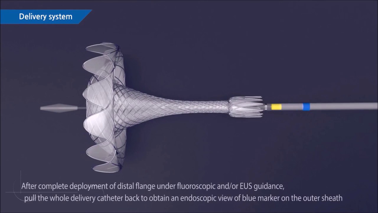 Niti S™ Gastrointestinal Metal Stent SPAXUS™ Stent Delivery System ...