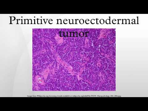 Primitive neuroectodermal tumor - YouTube