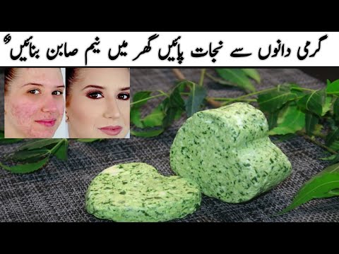 Garmi dane khatam karne ka tarika - garmi dano ka ilaj - garmi dane or kharish ka ilaj