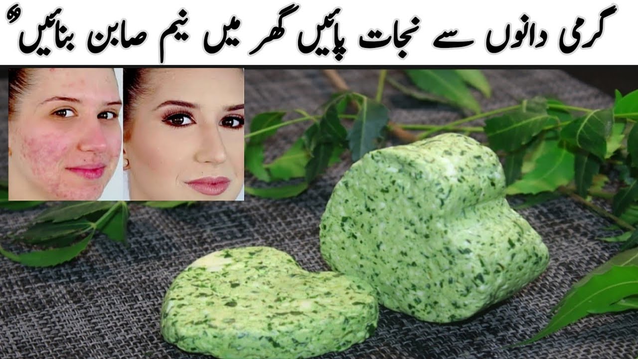 Garmi dane khatam karne ka tarika - garmi dano ka ilaj - garmi dane or ...