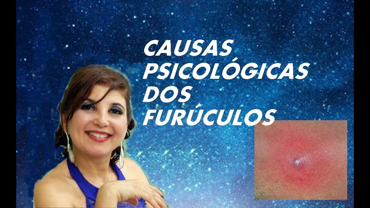 Causas Psicológicas dos Furúnculos - YouTube