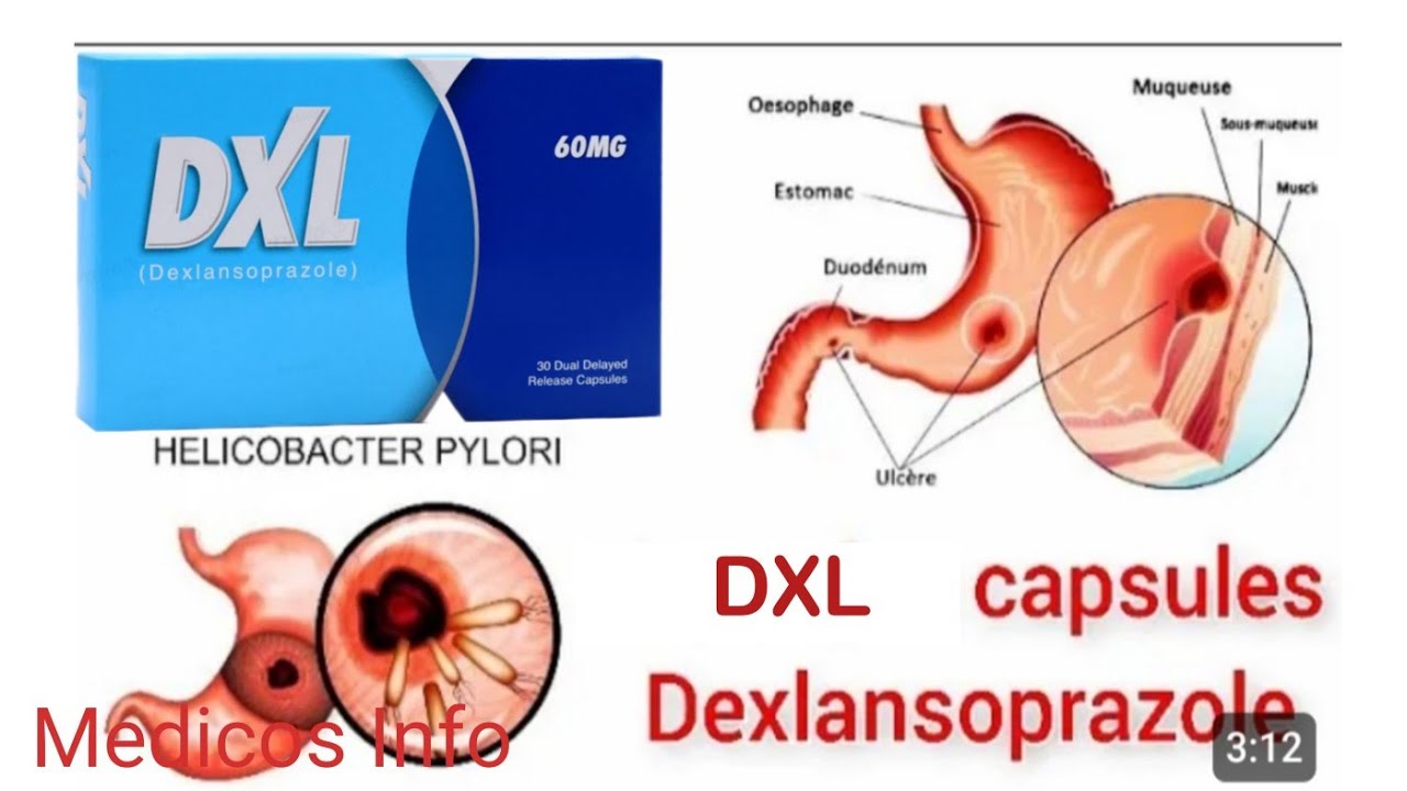 Dexlansoprazole uses benefit side effect in Urdu/Hindi |dxl 30mg, 60mg ...
