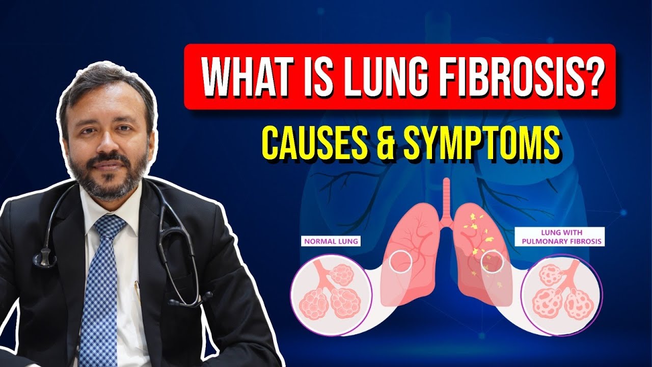 What is Lung Fibrosis Causes Symptoms and Types | Dr Jeenam Shah - YouTube