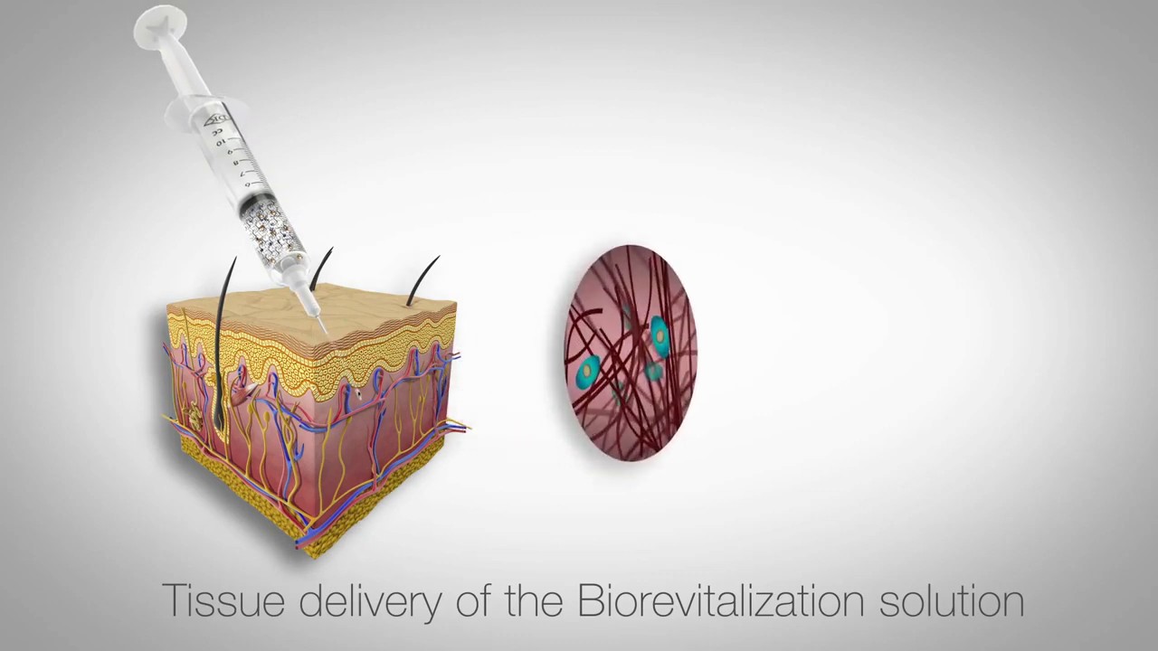 Video abstract In vitro study Skinbooster RRS HA injectable Skin Tech ...