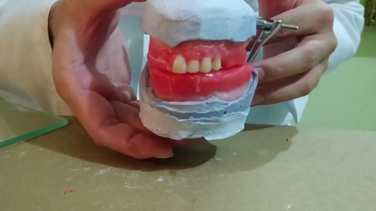 Enfilado de dientes artificiales en prótesis total (1/2) - YouTube