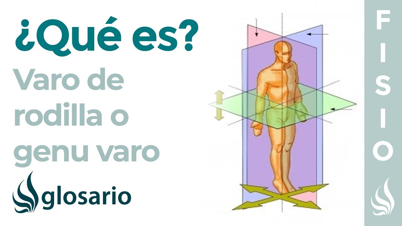 VARO DE RODILLA | Qué es, causas, síntomas, a quién afecta y ...