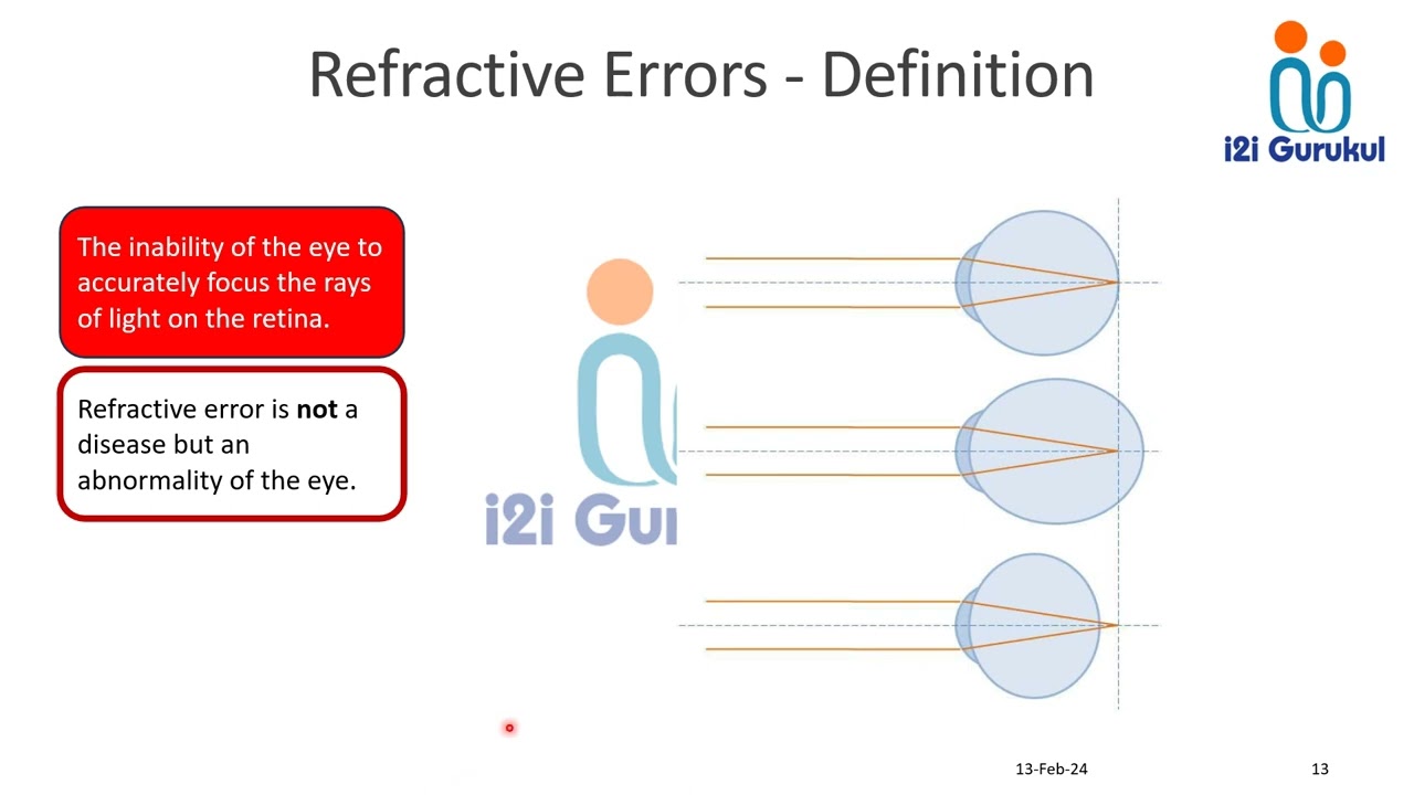 Inability To Focus Light Rays