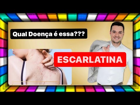 ESCARLATINA! O que é essa doença que acometeu muitas pessoas em São ...