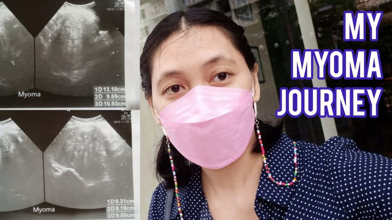 My Myoma Journey - YouTube