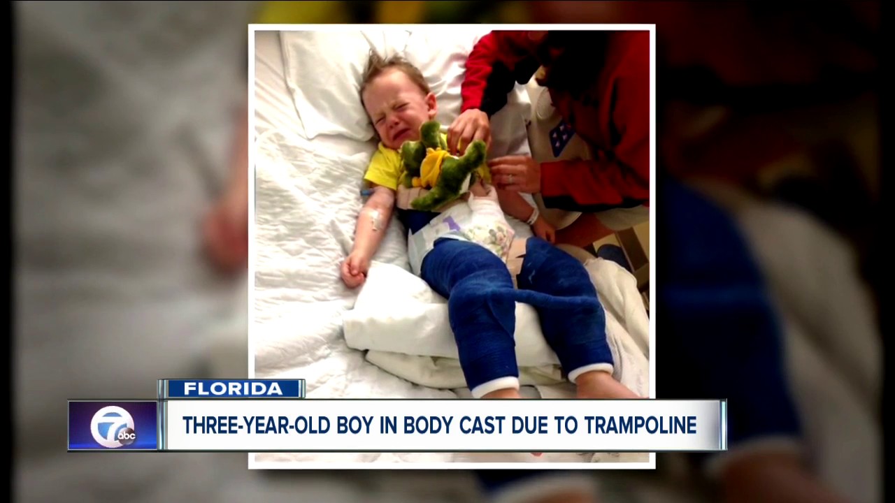 Three-year-old boy in body cast after trampoline-related injury - YouTube