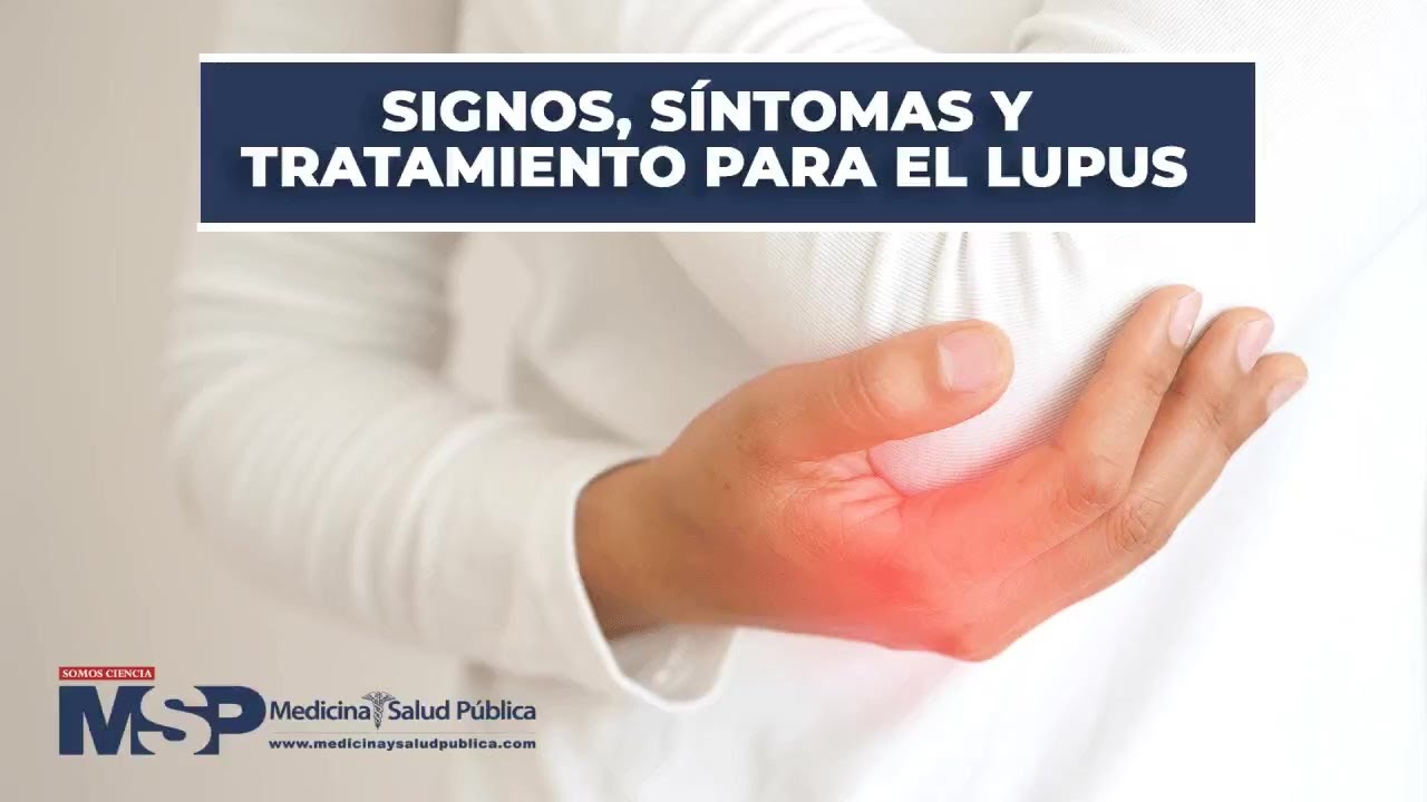 Signos, síntomas y tratamiento para el lupus #ExclusivoMSP - YouTube