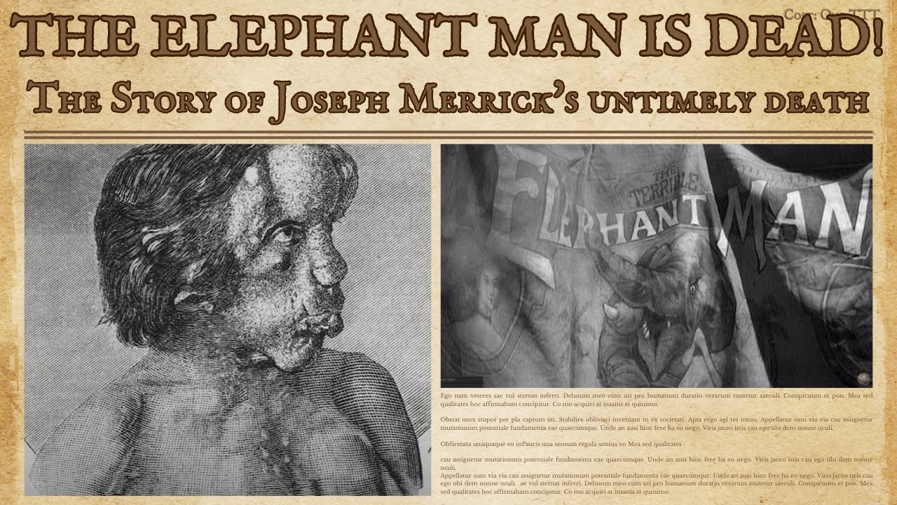 The ELEPHANT MAN IS DEAD! The Story of His Untimely Death - YouTube