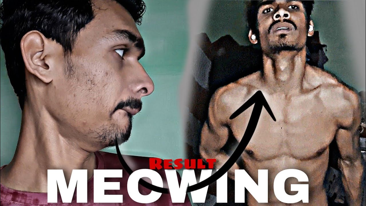 Mewing Results "Perfect Jawline"in 60 Days | HINDI - YouTube