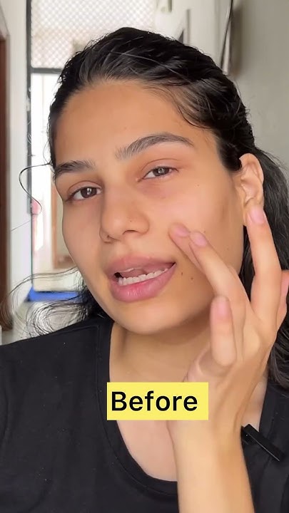 7 Days of Facial Massage 💆‍♀️ | Before & After Results (Watch Till End!) - YouTube